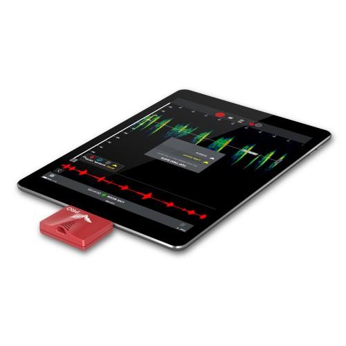 Echo Meter Touch 2 FAQs | Wildcare